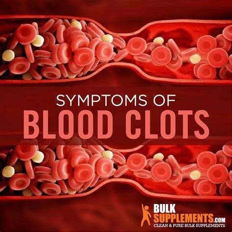 What Causes Blood Clots On Your Lungs At Sarah Gooding Blog