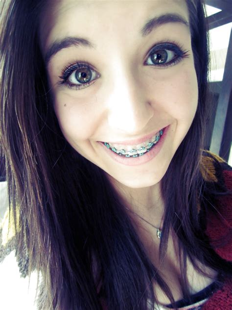 Teens With Braces 4 Porn Pictures Xxx Photos Sex Images 1628105 Pictoa