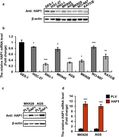 The Expression Level Of Hap1 Was Downregulated In Human Gastric Cancer