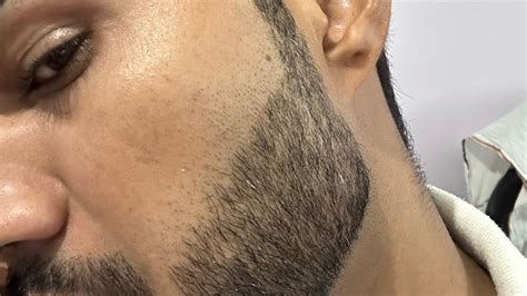 How Take Care Of Your Skin How To Do Dtan At Home Removing Tanning Skincare Diy Dtan Youtube