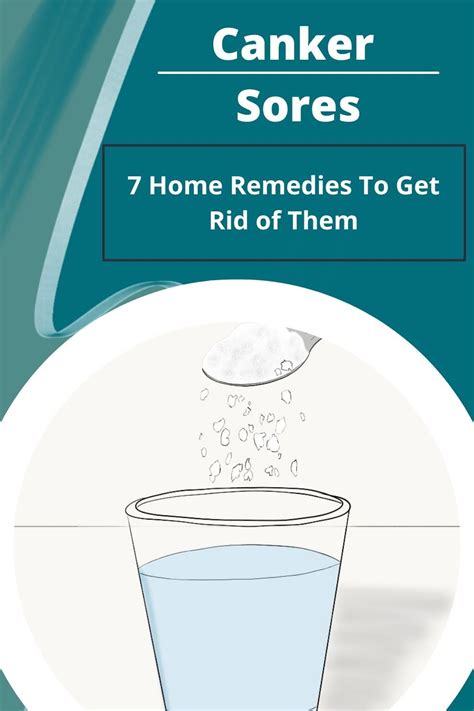 Canker Sore Home Remedies Artofit