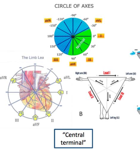 Electrocardiogram Physiology Flashcards Quizlet