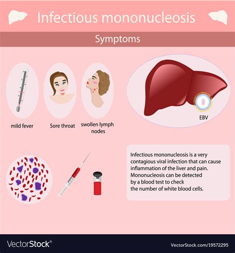 Infectious Mononucleosis Causes Signs And Symptoms Diagnosis And My Xxx Hot Girl