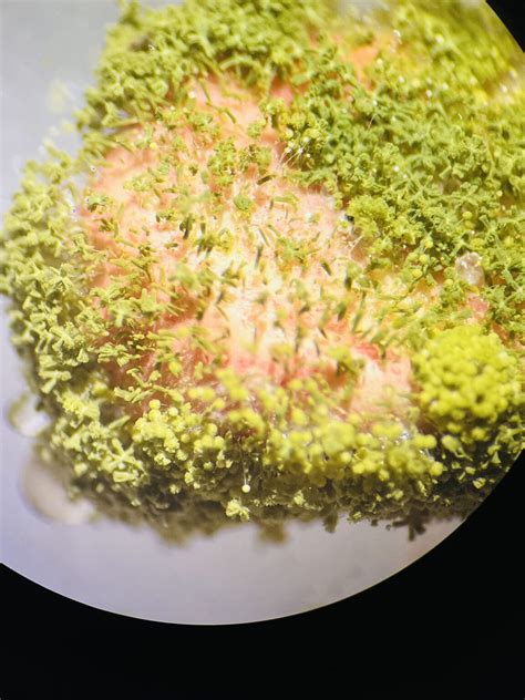 Shreya Das On Linkedin Aspergillus Flavus Is A Common Mold Belonging