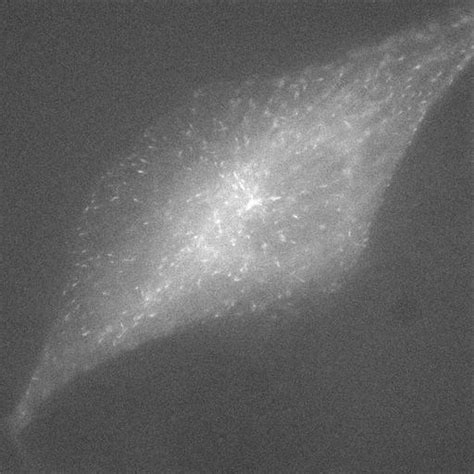 Cil26571 Homo Sapiens Epithelial Cell Renal Cell Carcinoma Cil