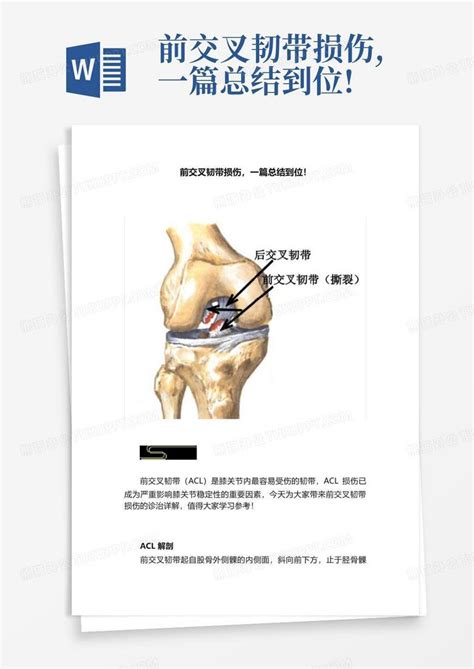 前交叉韧带损伤 一篇总结到位 Word模板下载 编号qnyobzmk 熊猫办公