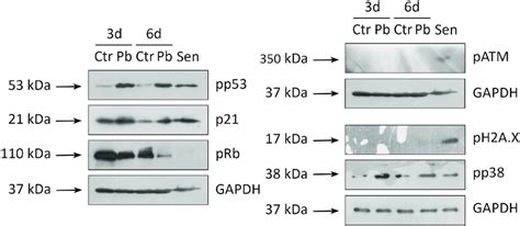 Pb Stimulates Activation Of Both P53p21rb And P38 Mapk Pathways In