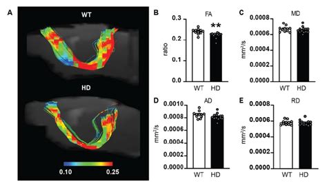 Diffusion Metrics Indicate Structural Alterations In M2 Cortex Sc Tracts Download Scientific