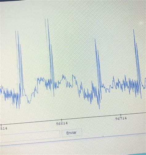 Analog Read With Arduino And Nodemcu Esp Issue Esp Arduino Github