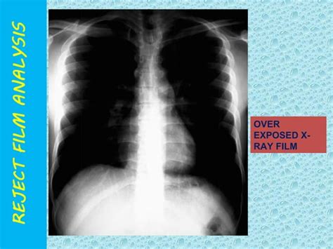 Reject Film Analysis Ppt