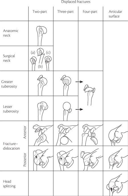 Proximal Humerus Fracture Peds Wikem