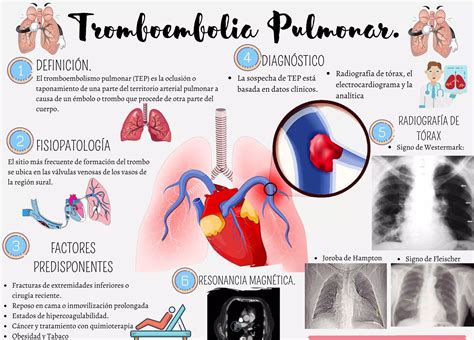 Quiz Sobre Tromboembolismo Pulmonar University Quiz Wayground