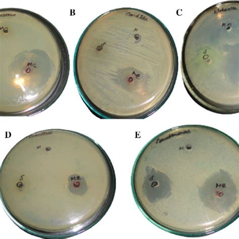 Antimicrobial Activity For Ice And Cfce A Enterococcus Faecalis B Download Scientific