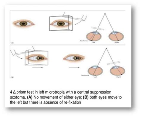 Sensory Evaluation Optography
