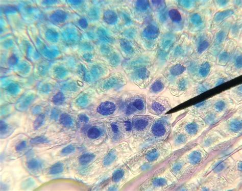 Microscopes Biology Gcse At Victoria Otero Blog