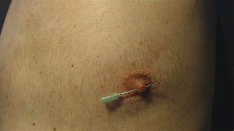 Nipple Needle Pain Xhamster