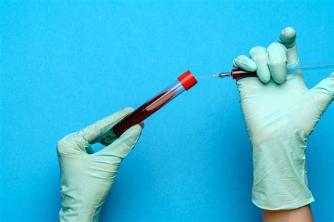 Hemoglobin K čemu Nám Je A Co Dělat Pokud Ho Nemáme Dost Flowee