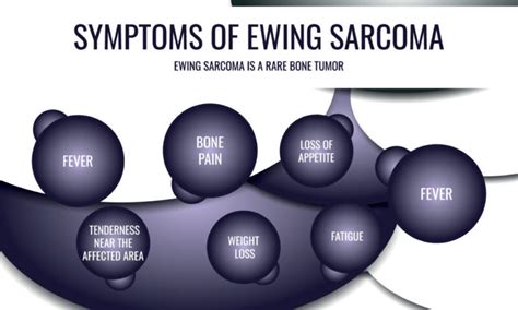 Ewing Sarcoma Symptoms Causes Stages Diagnosis And Treatment Oncodaily