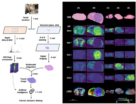 Spatial Metabolomics In Oncology Transforming Cancer Diagnostics With