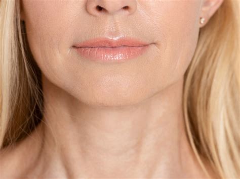 10 Proven Solutions To Say Goodbye To Upper Lip Wrinkles