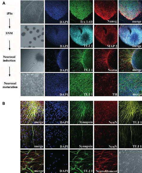 A Differentiation Of Gd Ipsc To Dopaminergic Neurons Briefly Ipsc Download Scientific