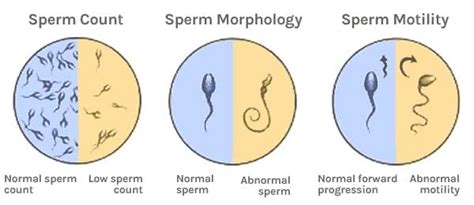 Sperm And Semen Testing And Evaluation Centers Leading Edge Laboratories For Sperm And Semen