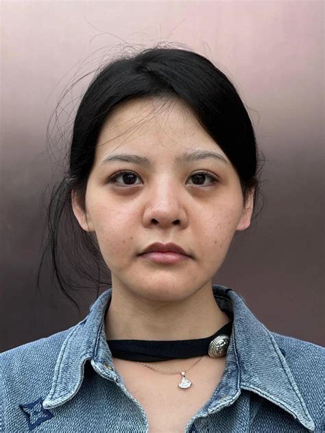 有被自己嚇到🤯 39歲第一次嘗試醫美，花了九萬台幣 想要問一下，我這算成功嗎？🥹