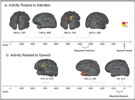 A Spatiotemporal Dynamics Of Reconstructed Sources Of Brain Download Scientific Diagram
