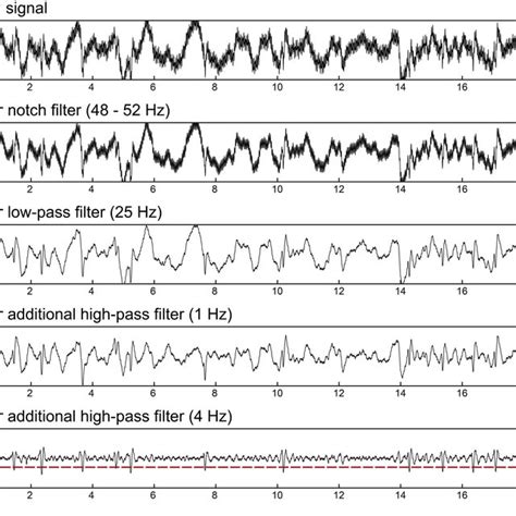 Pdf Protocol For Spike Triggered Closed Loop Auditory Stimulation During Sleep In Patients