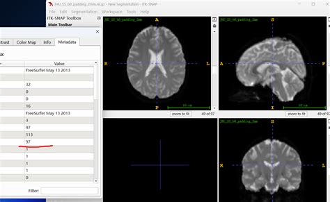 matlab添加工具包nifti（详细）及脑mri 重采样 nifti atlas csdn博客