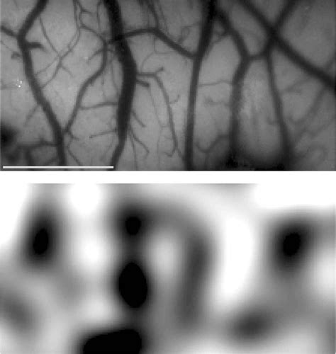 Figure 1 From Functional Optical Imaging Of Intrinsic Signals In