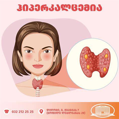 ჰიპერკალცემია საყურადღებო მდგომარეობა ჯანმრთელობა Vidal Ge