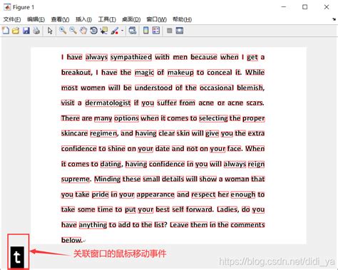 【matlab图像处理实用案例详解（6）】—— 基于特征匹配的英文印刷字符识别 Csdn博客