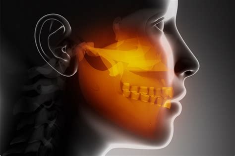 Tmj Dysfunction Ag Dentistry