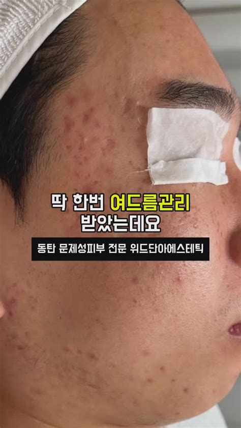 동탄여드름관리 동탄피부관리 동탄왁싱 무슨말이 더 필요할까요 눕빼 4월 선착순 이벤트 20회는 몇자리 안남았어요 1회당 65000원으로 살 쪽 빼는데 이건 정말