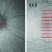 Scan Patterns Used In Microscope Integrated OCT A B Scan Line B Download Scientific