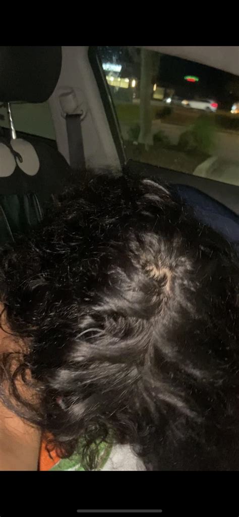 Am I Going Bald R Hair