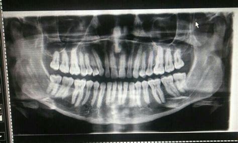 بانوراما الاسنان Sina Scan سينا سكان للاشعة والتحاليل