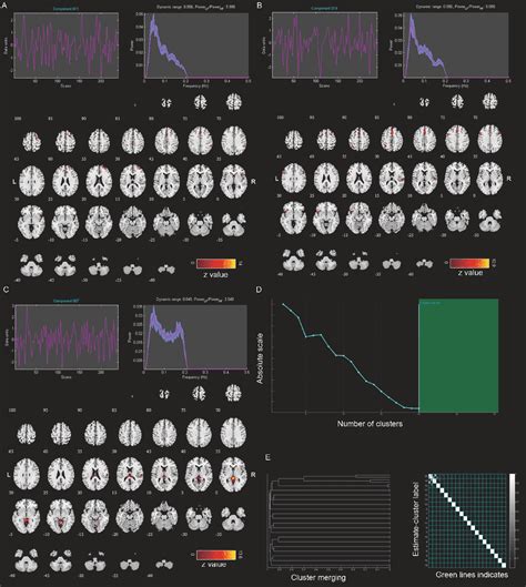 Figure 3 From Effective Connectivity Of The Large Scale Brain Networks For Procrastination A