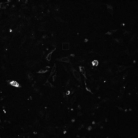 Background Subtraction In Scikit Image Image Analysis Image Sc Forum