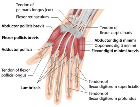 Ulna Bone Spur Wrist