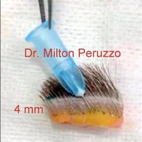 Dr Milton Peruzzo Dr Milton Peruzzo • Instagram Photos And Videos