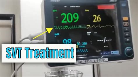Video Thumbnail Adenosine In Supraventricular Tachycardia Svt How