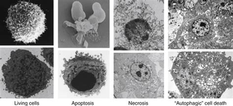 Apoptosis Necrosis And Autophagy Oncohema Key
