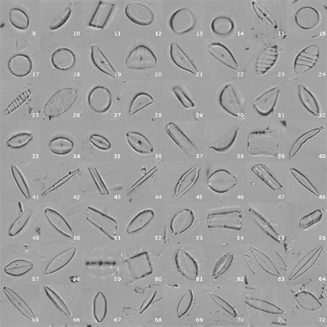 Diatom Classes Examples For Segmented Dataset Download Scientific Diagram