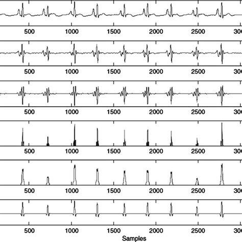 Pdf Automatic Classification Of Heartbeats Using Wavelet Neural Network