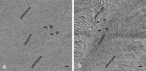Sem Micrographs Of The Longitudinal Enamel Sections With Or With A Download Scientific Diagram