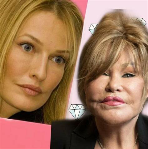 Jocelyn Wildenstein Used To Be Really Beautiful Before Getting So Many