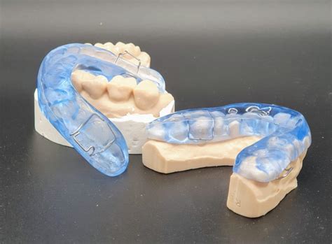 What Is An Occlusal Splint At Alyssa Hobler Blog