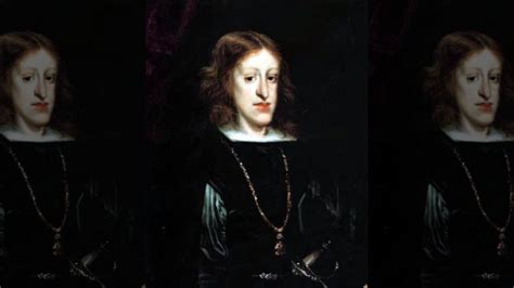 Royal Dynasty Facial Deformity Known As ‘habsburg Jaw Was Caused By